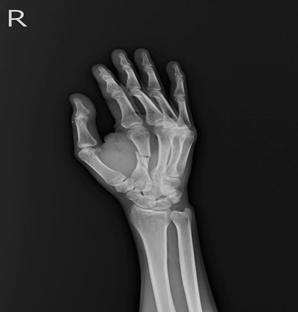 Hand - Priority Diagnostics